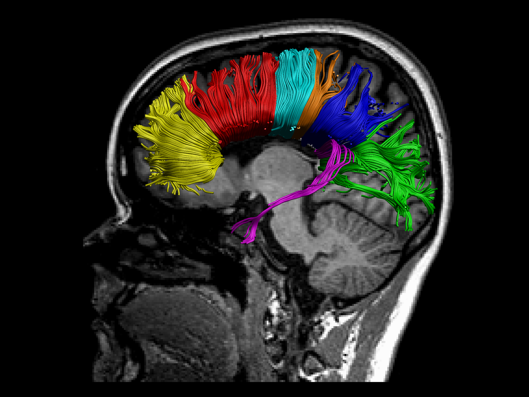 Additional measurement equipment — Department of Rehabilitation ...